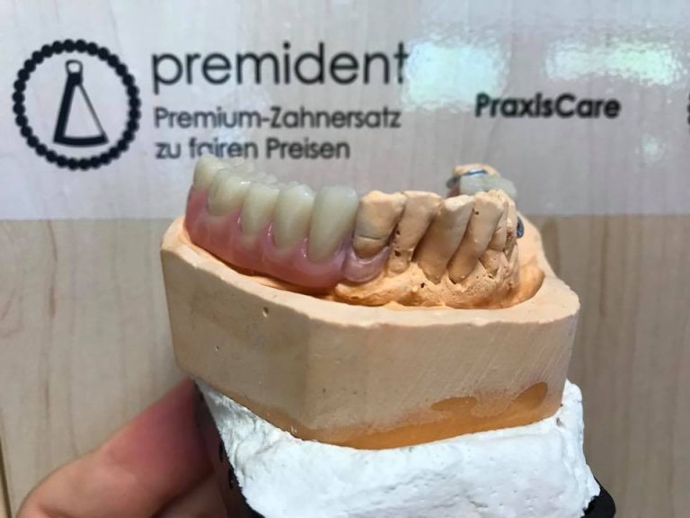 Hybridprothese | premident