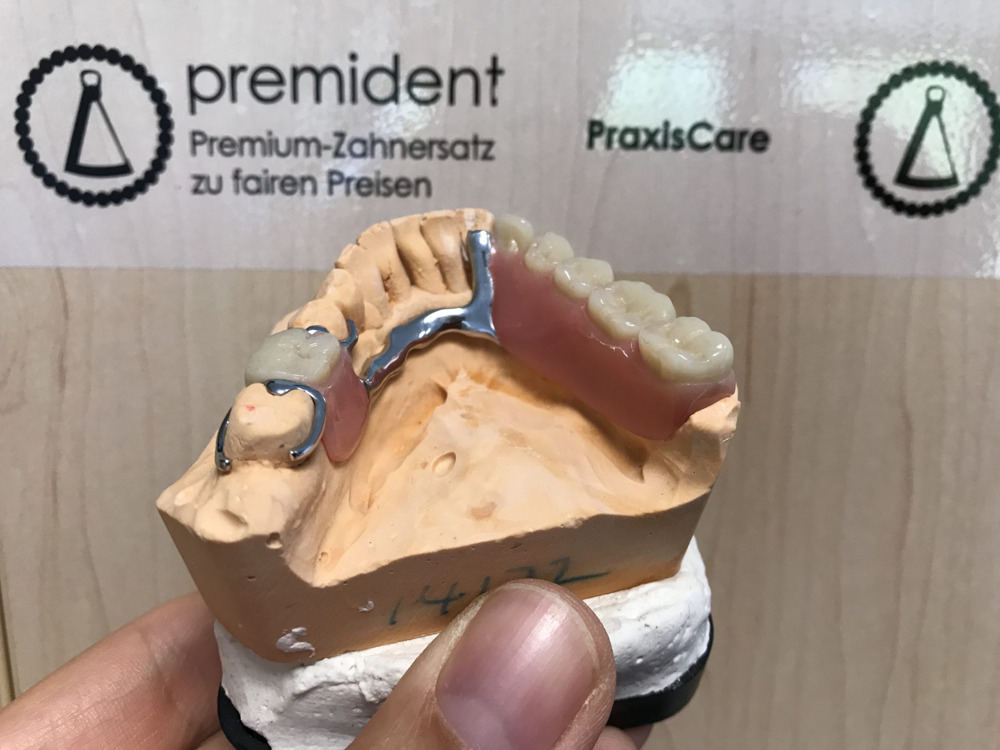 Hybridprothese | premident